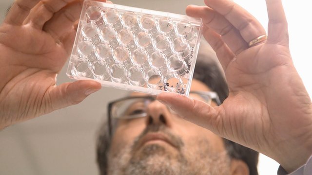 BBC News - Zika virus could become 'explosive pandemic'