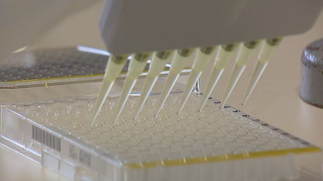 New antibiotic could transform C. diff treatment - BBC News