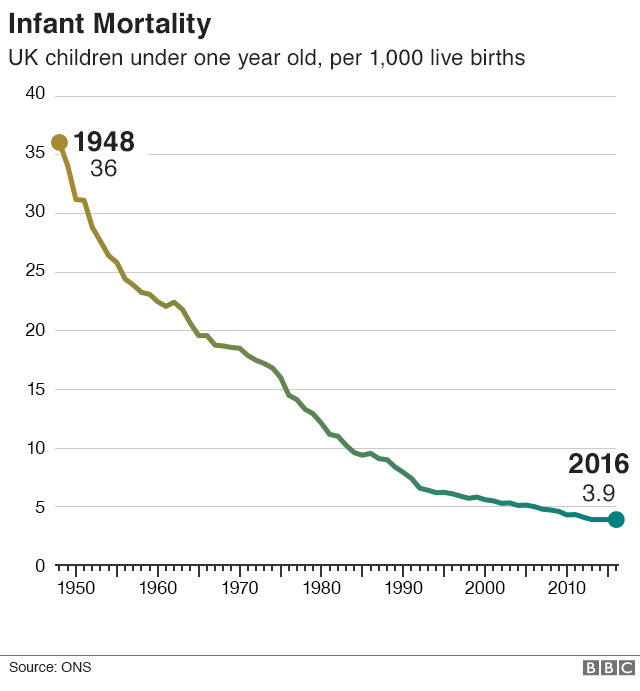 Digeorge Syndrome Life Expectancy Charts