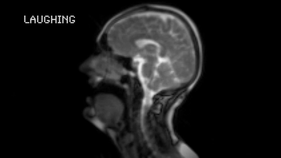 What happens when we laugh? - BBC News