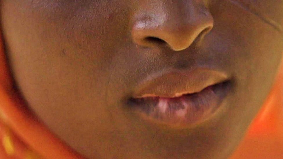 Types Of Skin Bleaching Products