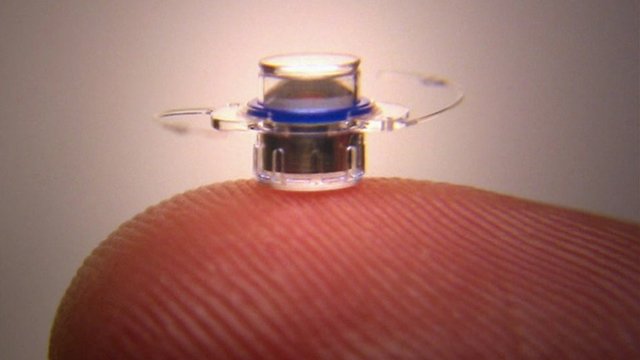 Tiny telescope helps restore sight in Manchester hospital - BBC News