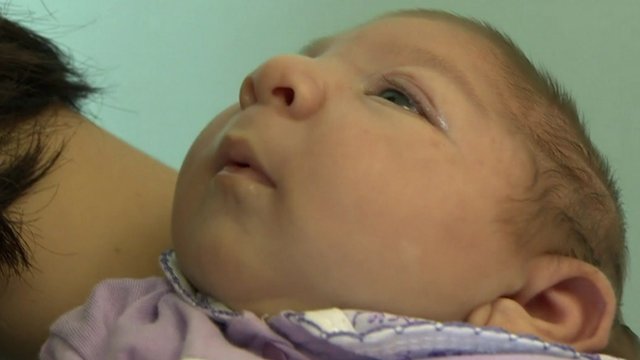Zika Brazil mothers' plight - BBC News