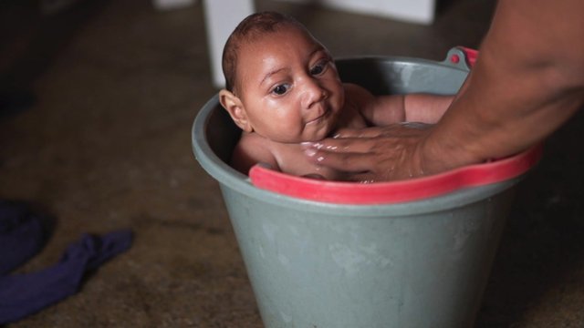 The story of the Brazil's Zika 'bucket baby' - BBC News