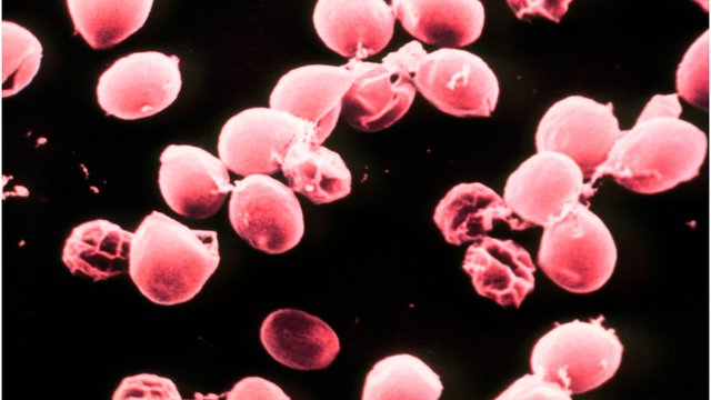 How dangerous is cryptosporidium? - BBC News