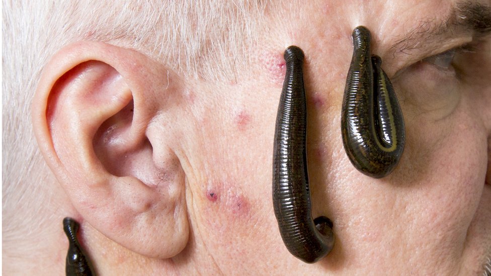 Dentes De Sanguessugas Imagens De Sanguessuga Sem Royalties