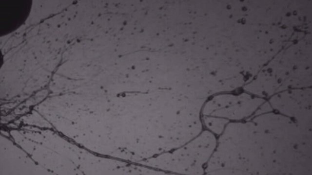 How snot moves through the air - BBC Newsround