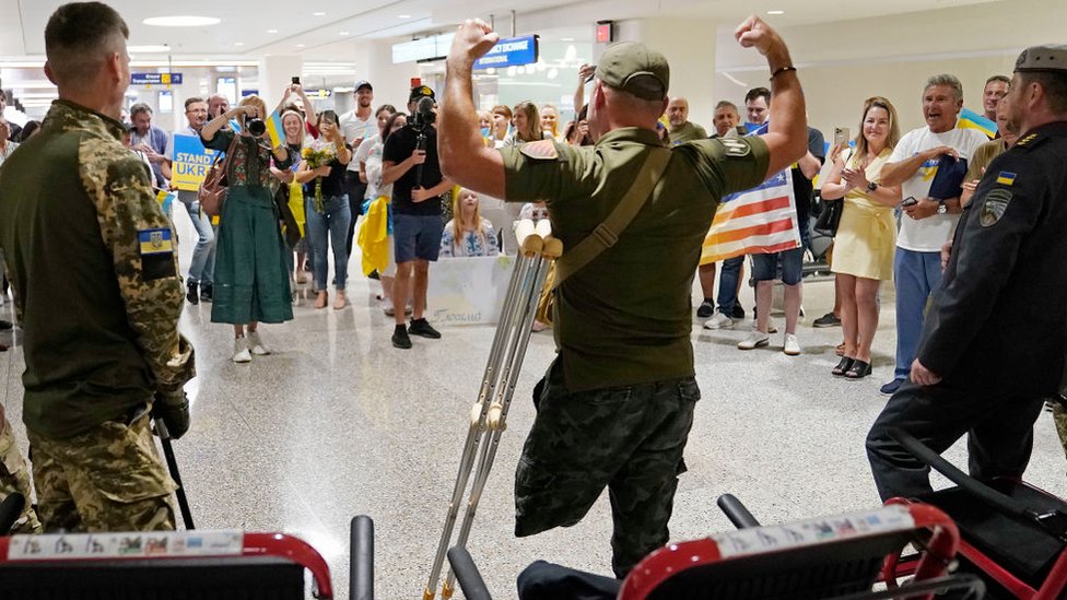Сталеві кінцівки як військовим повертають ноги і руки втрачені на війні з Росією Читайте на