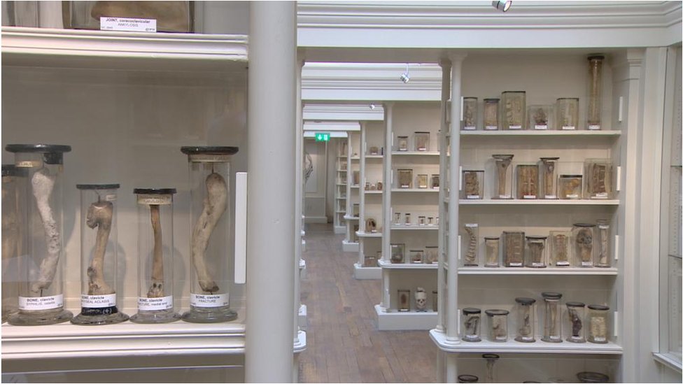 Edinburgh's Surgeons' Hall Museums reopens after £4m revamp - BBC News