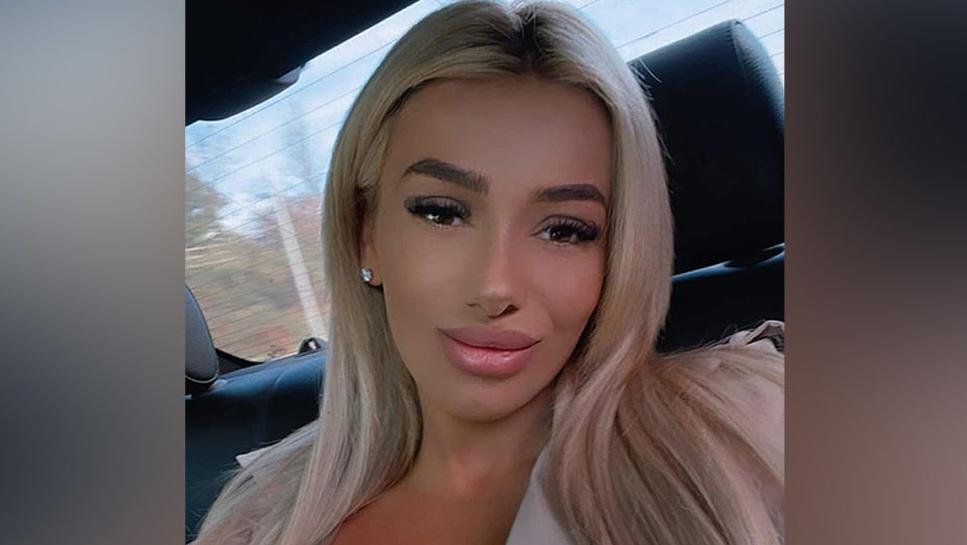 Celebrities That Died From Plastic Surgery 60 Photos - Moonagedaydream.film